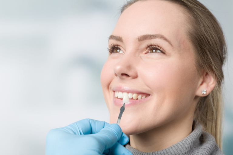 Quanto custa colocar facetas nos dentes? Saiba neste artigo!